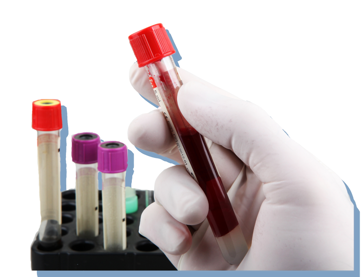IgE Testing Limitations & Scope | The NAET Clinic