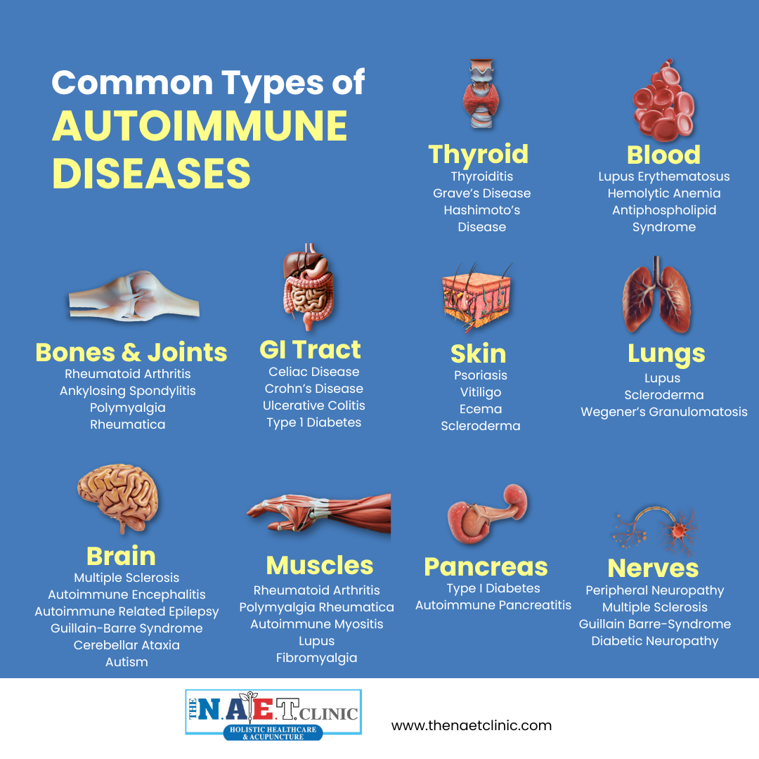 The NAET Clinic | NAET Therapy Has Been Helping Patients Regain Their ...