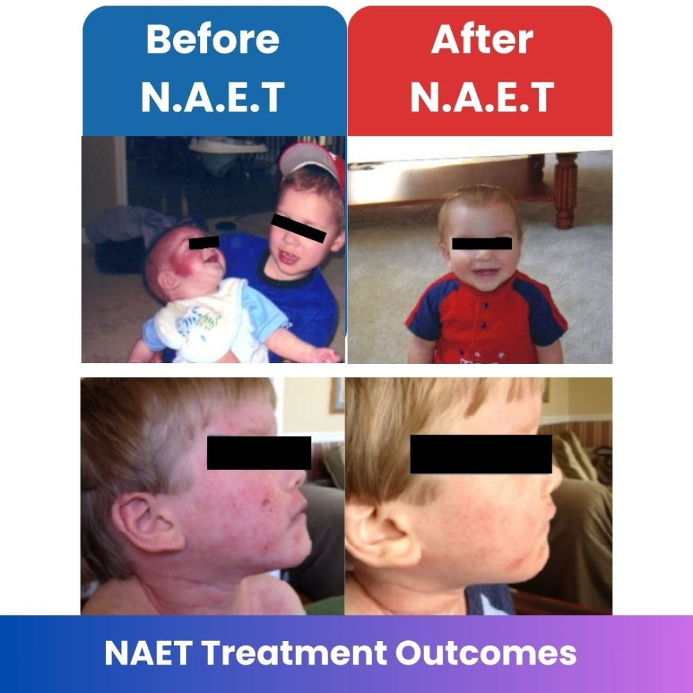 Skin Health Services | The NAET Clinic
